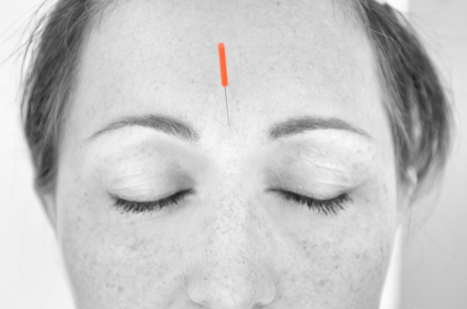 Possible Negative Acupuncture Side Effects - Thumos Health Center