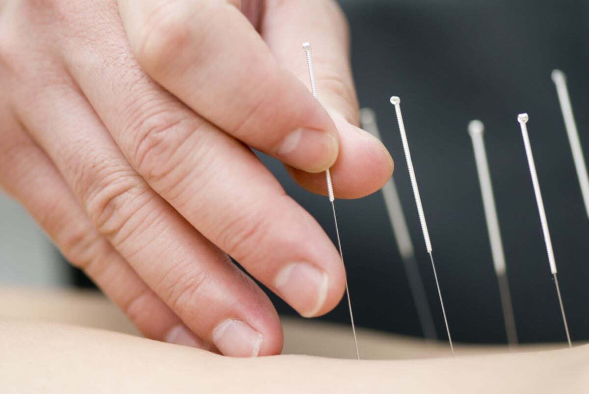5 Toxins Acupuncture Can Help Detox - Thumos Health Center